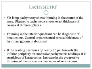 Keratoconus | PPTX