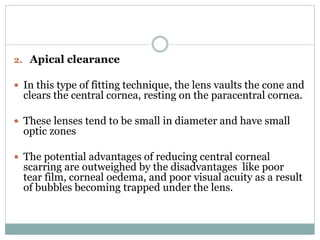 Keratoconus | PPTX