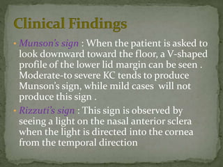 Keratoconus | PPT