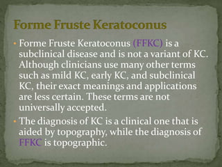 Keratoconus | PPT