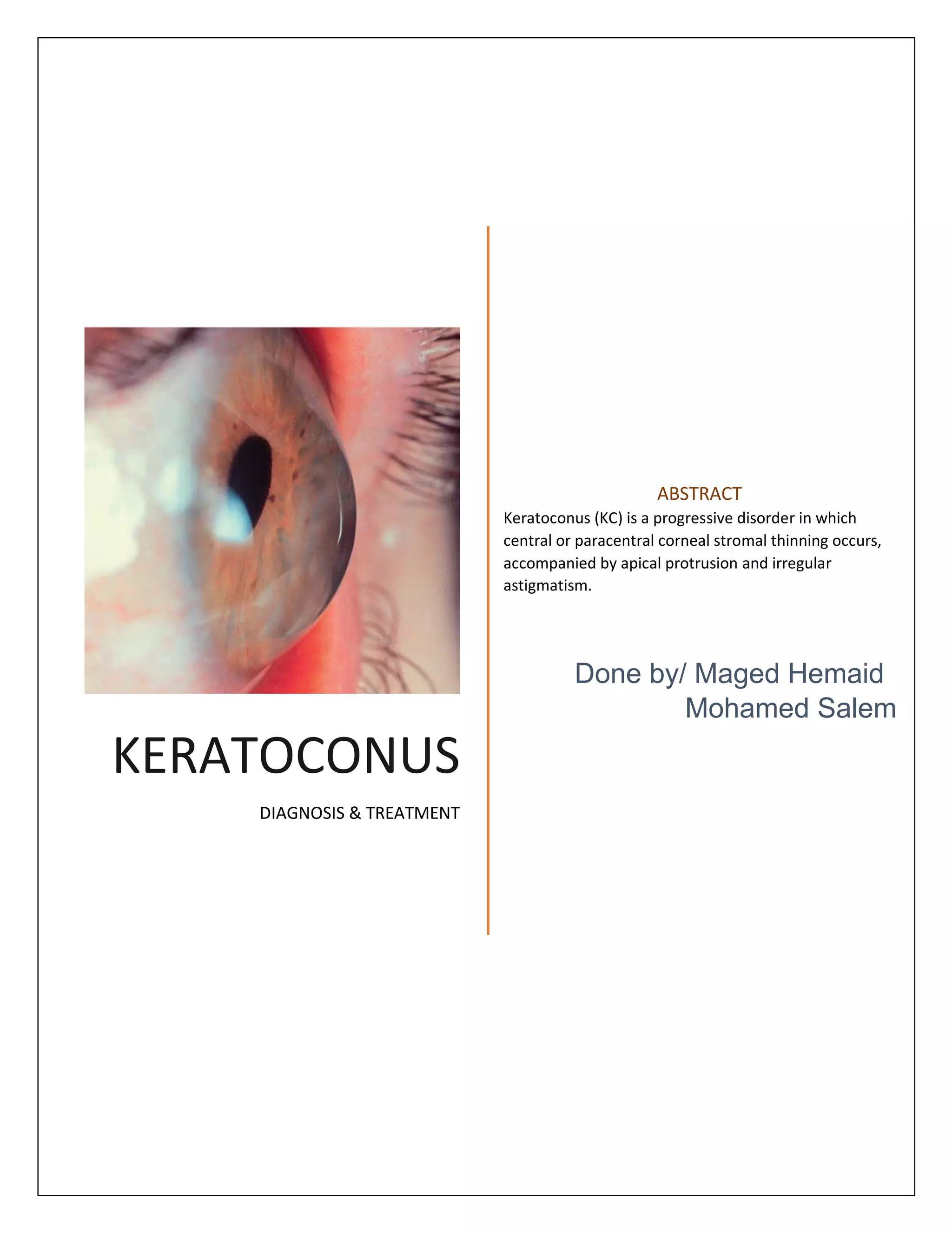 Keratoconus | PDF