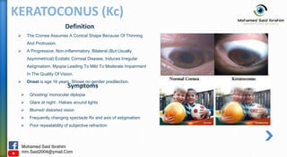 Keratoconus القرنية المخروطية | PPTX