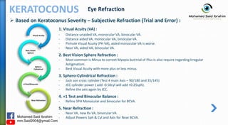 Keratoconus القرنية المخروطية | PPTX