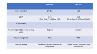 Keratoconus a case of asymmetric keratoconus and management protocol | PPT