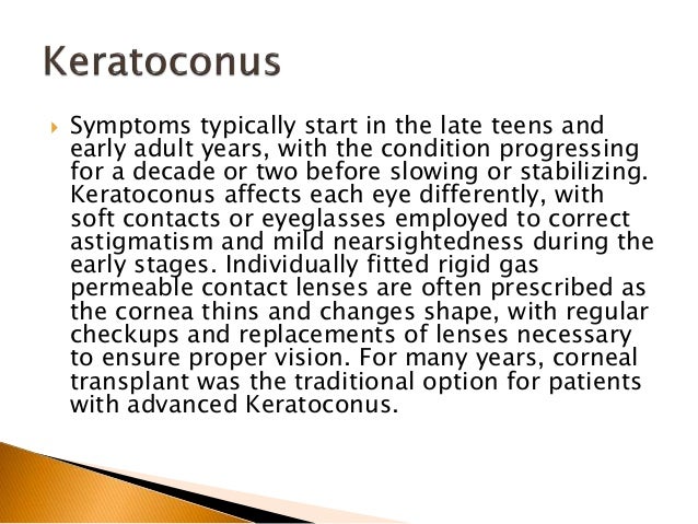Keratoconus A Gradual Thinning Condition Of The Cornea