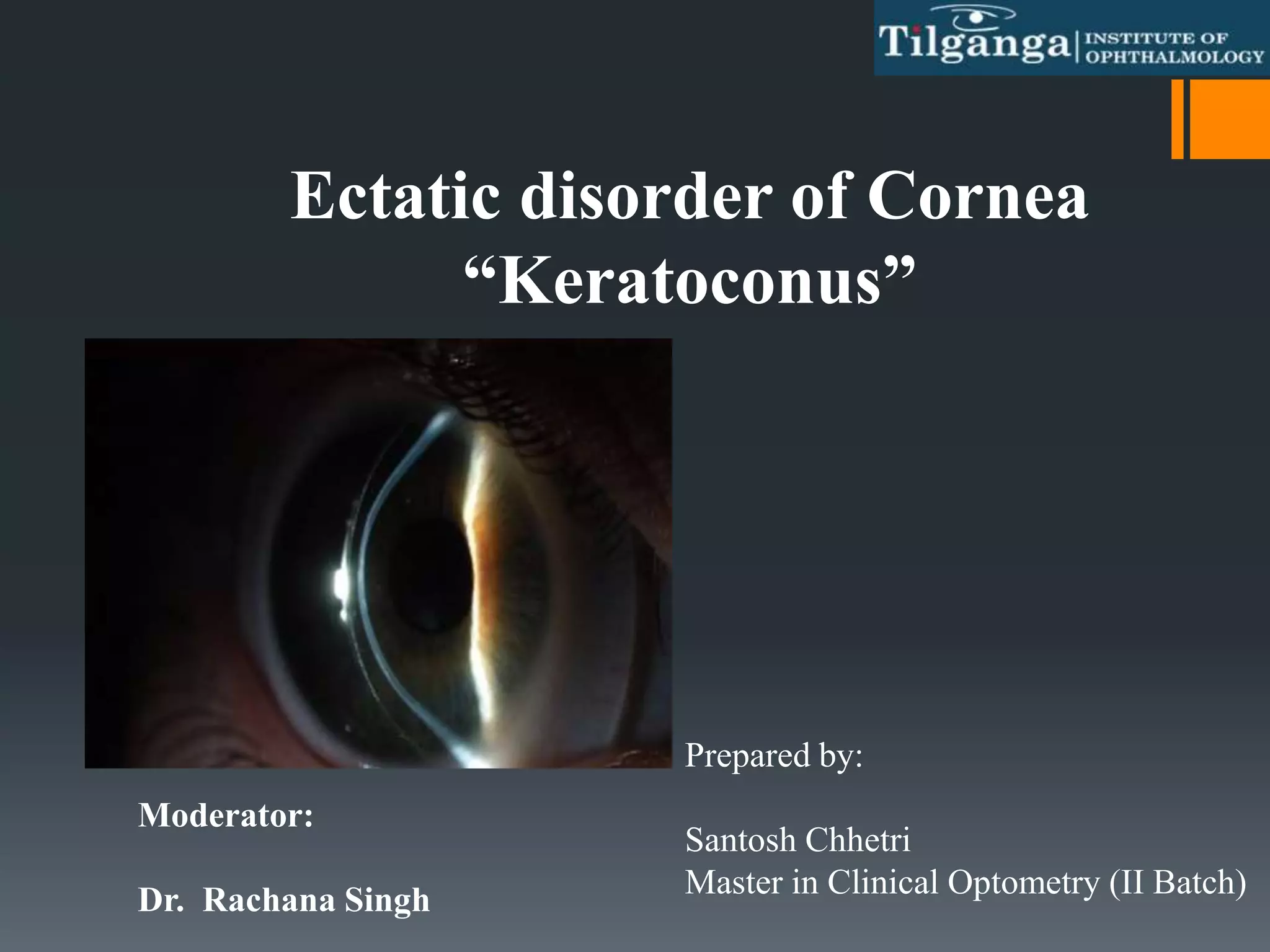 Keratoconus and Its management | PPTX