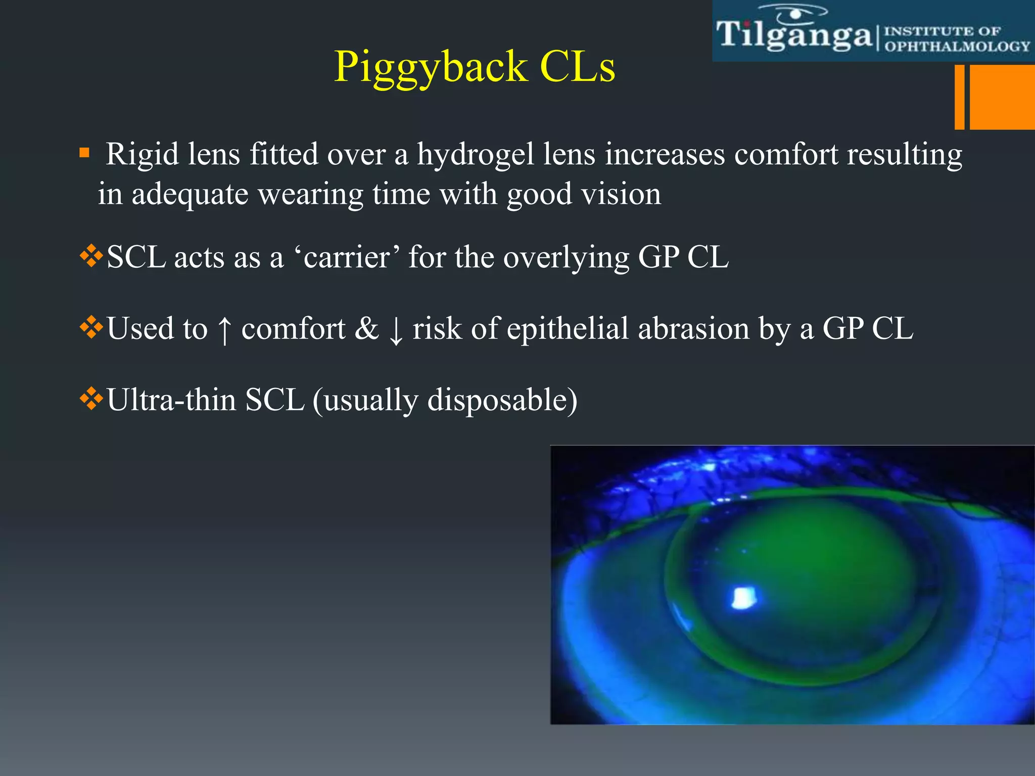 Keratoconus and Its management | PPTX | Eye and Vision Conditions | Diseases and Conditions