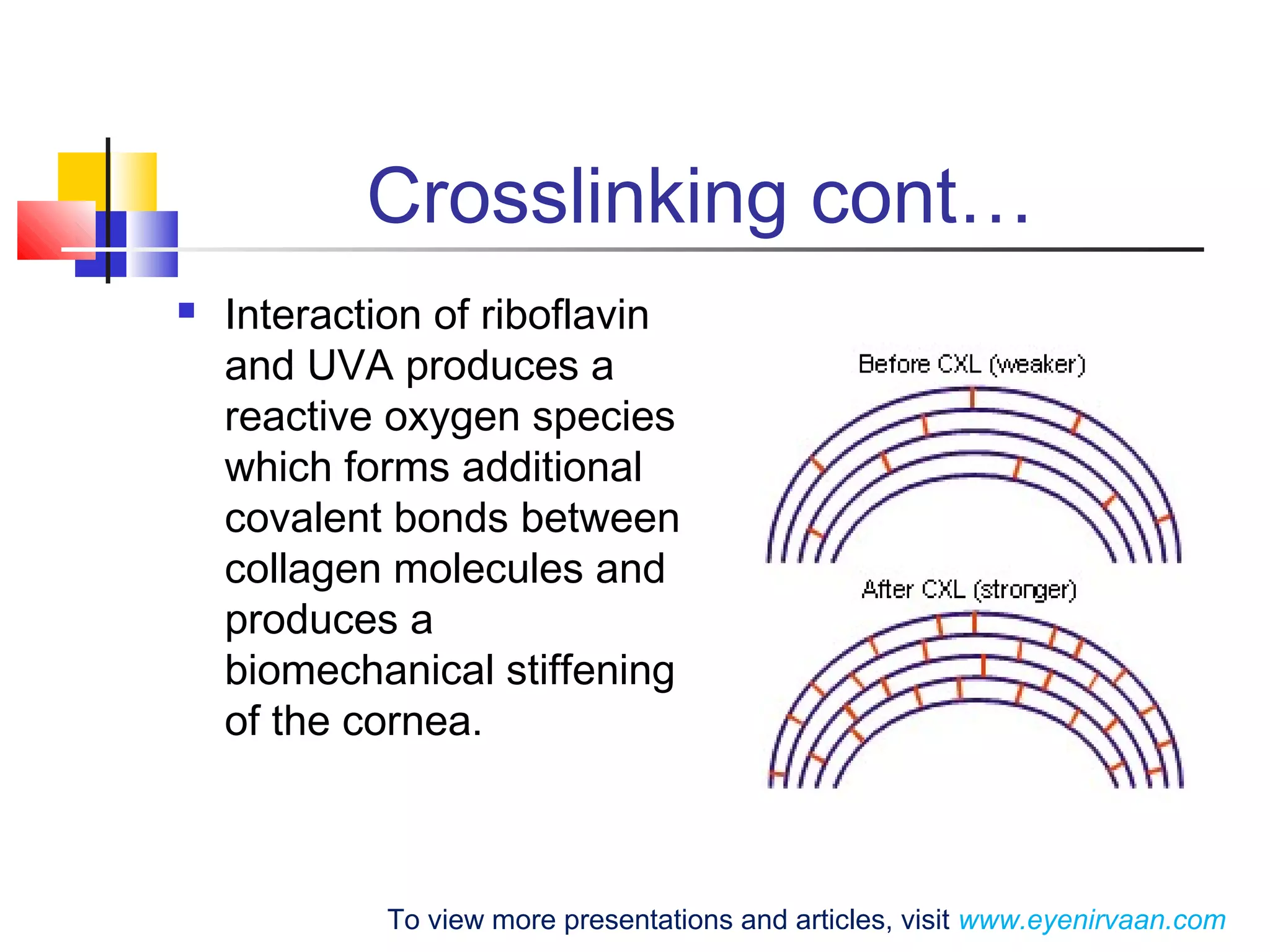 Keratoconus and collagen cross linking- Basic opthalmoscopy findings ...