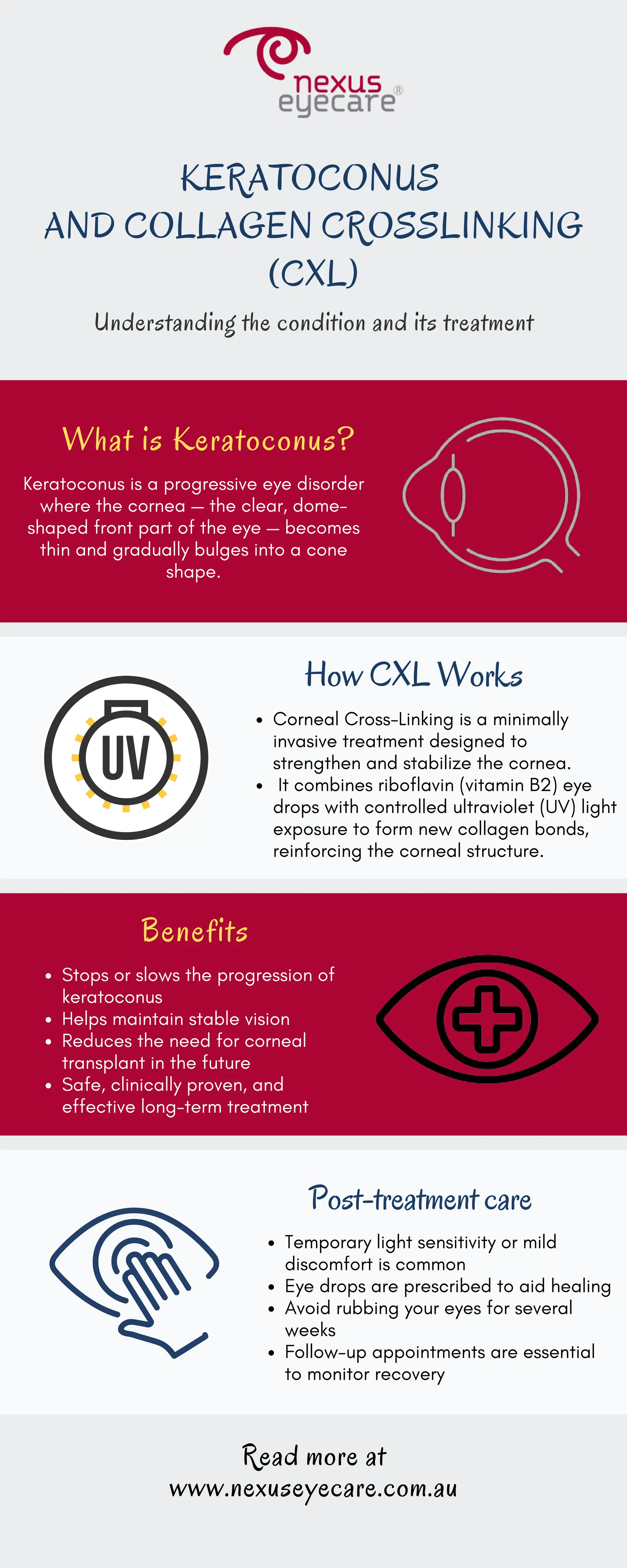 Keratoconus and Collagen Crosslinking (CXL) | PDF