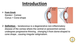 Keratoconus & it’s management (kunj).pptx