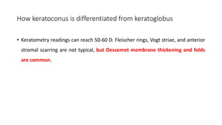 Keratoconus, lenticonus, lentiglobus , microspherophakia & | PPTX