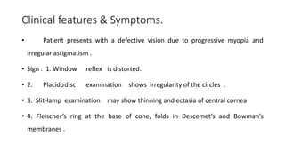 Keratoconus, lenticonus, lentiglobus , microspherophakia & | PPTX