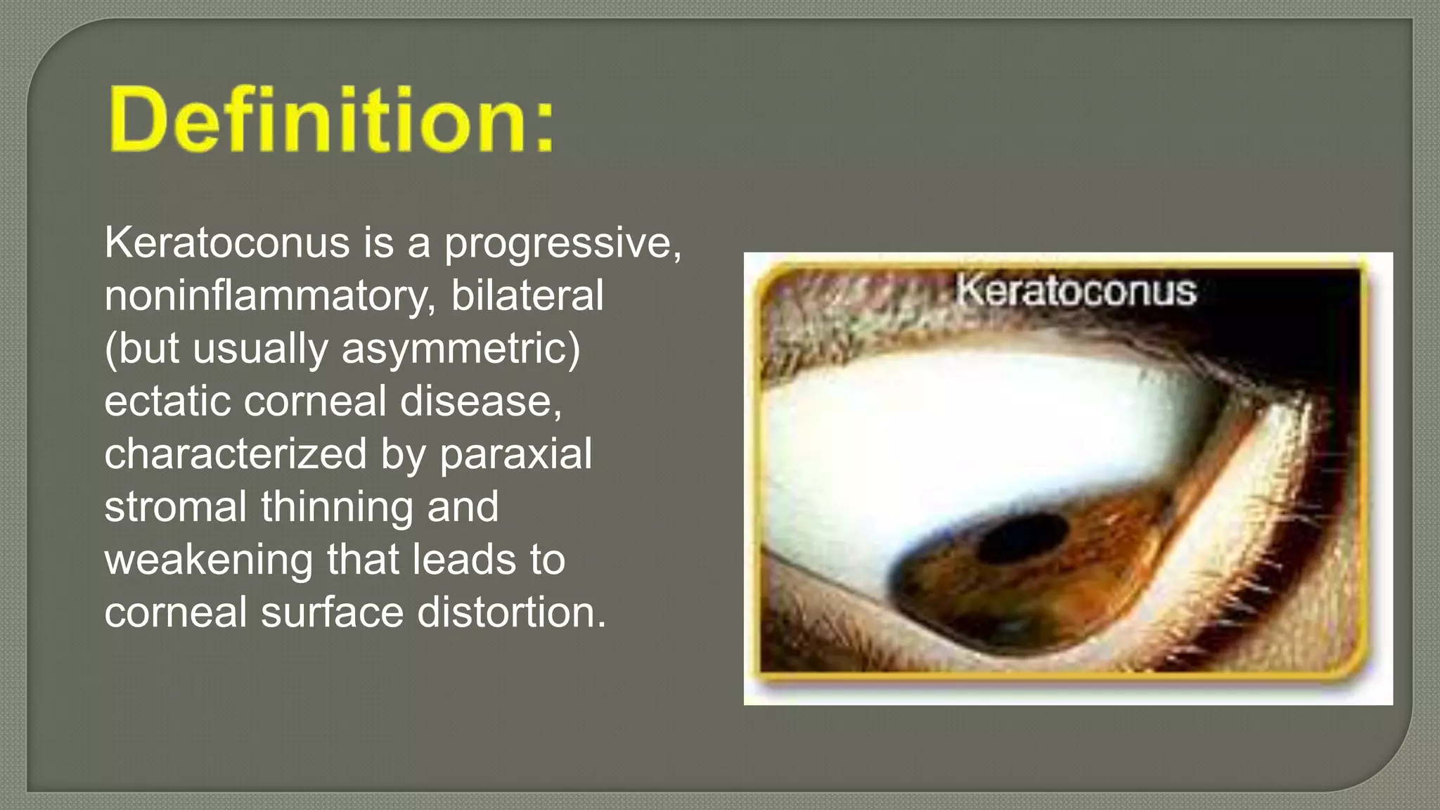 Keratoconus mangment | PPTX