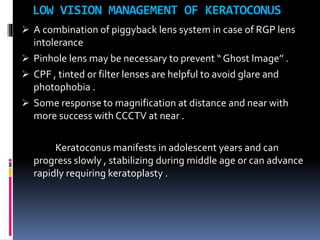 Keratoconus MANAGEMENT | PPTX