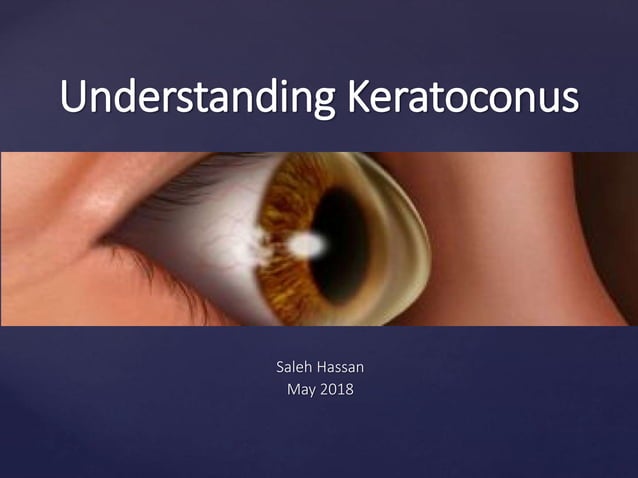 Keratoconus presentation | PPT