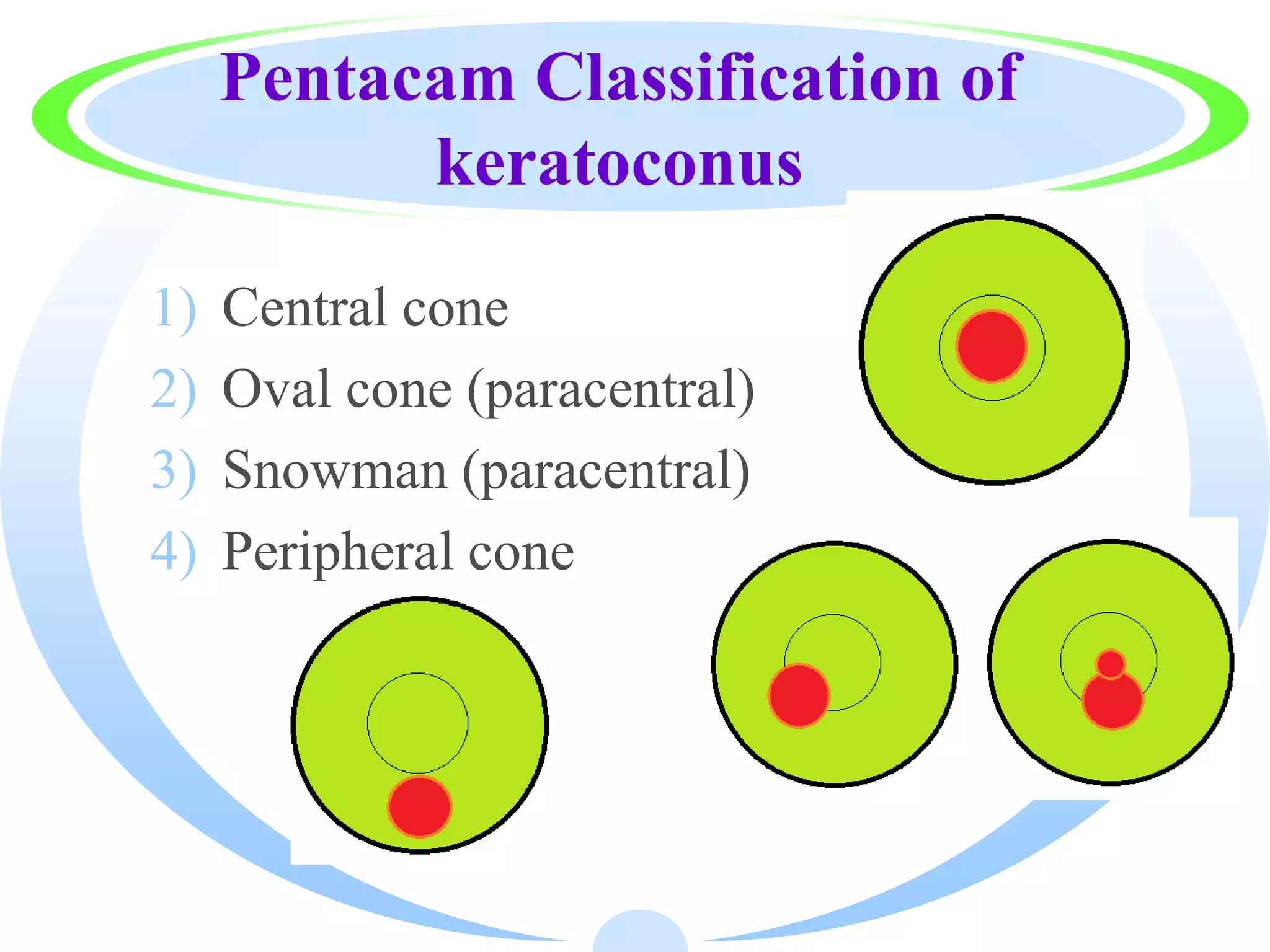 Keratoconus refraction | PPT