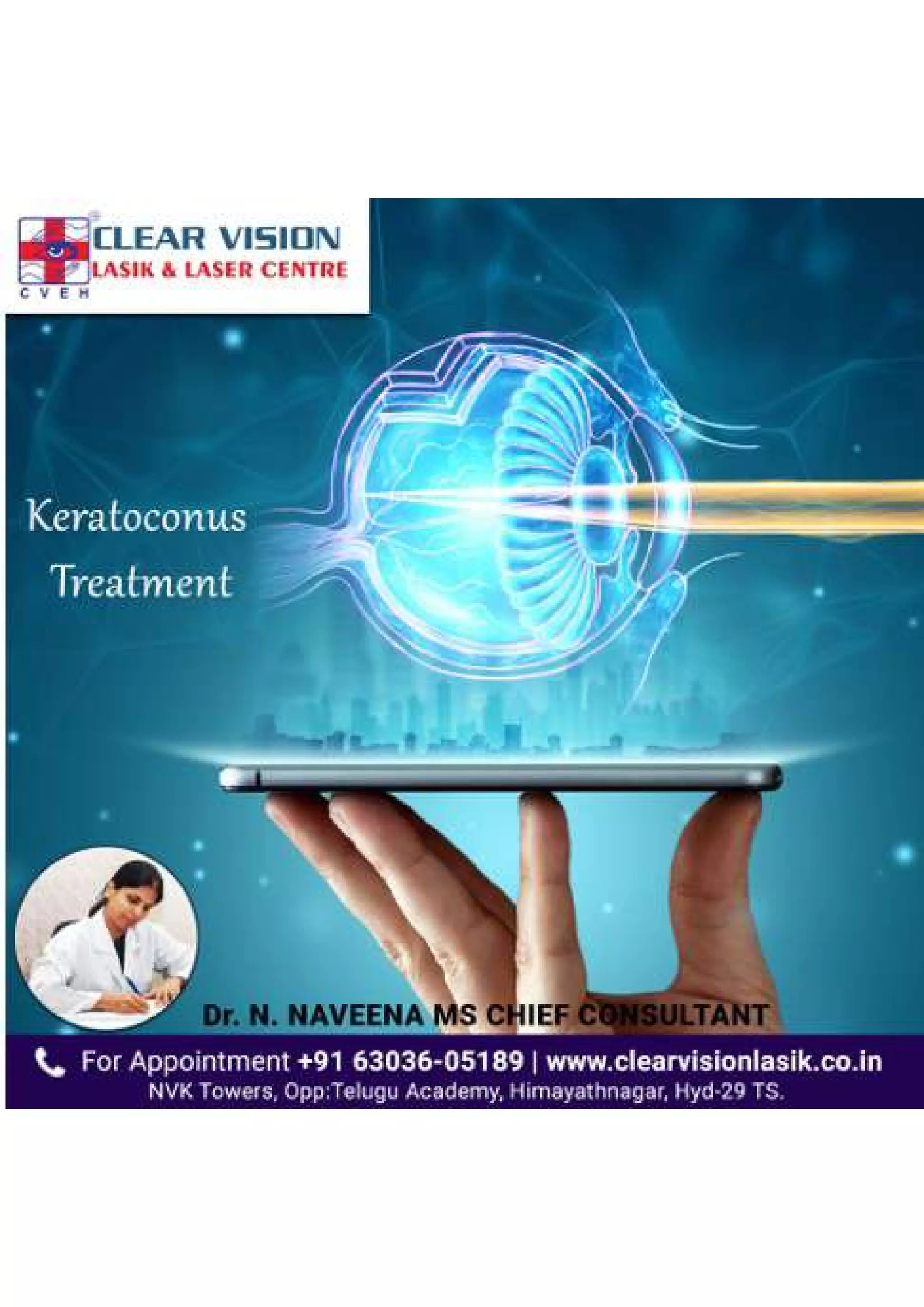 Keratoconus Surgery in Himayath Nagar | PDF