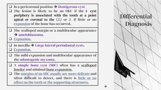 Keratocystic odontogenic tumors(KCOT) or Odontogenic Keratocyst(OKC)OKC ...
