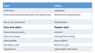 Keratodermas | PPTX