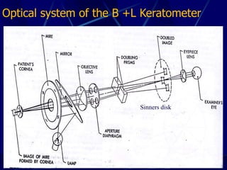 Keratometer | PPTX