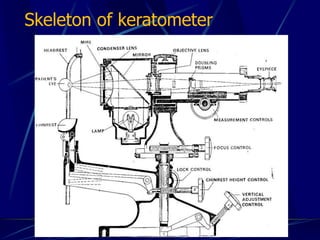 Keratometer | PPTX