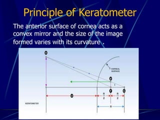 Keratometer | PPTX