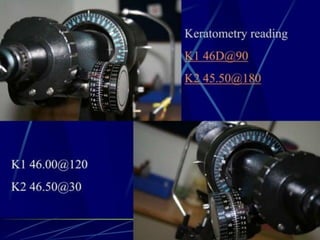 Keratometer .pdf