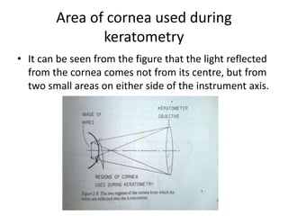 Keratometer and keratometry | PPTX