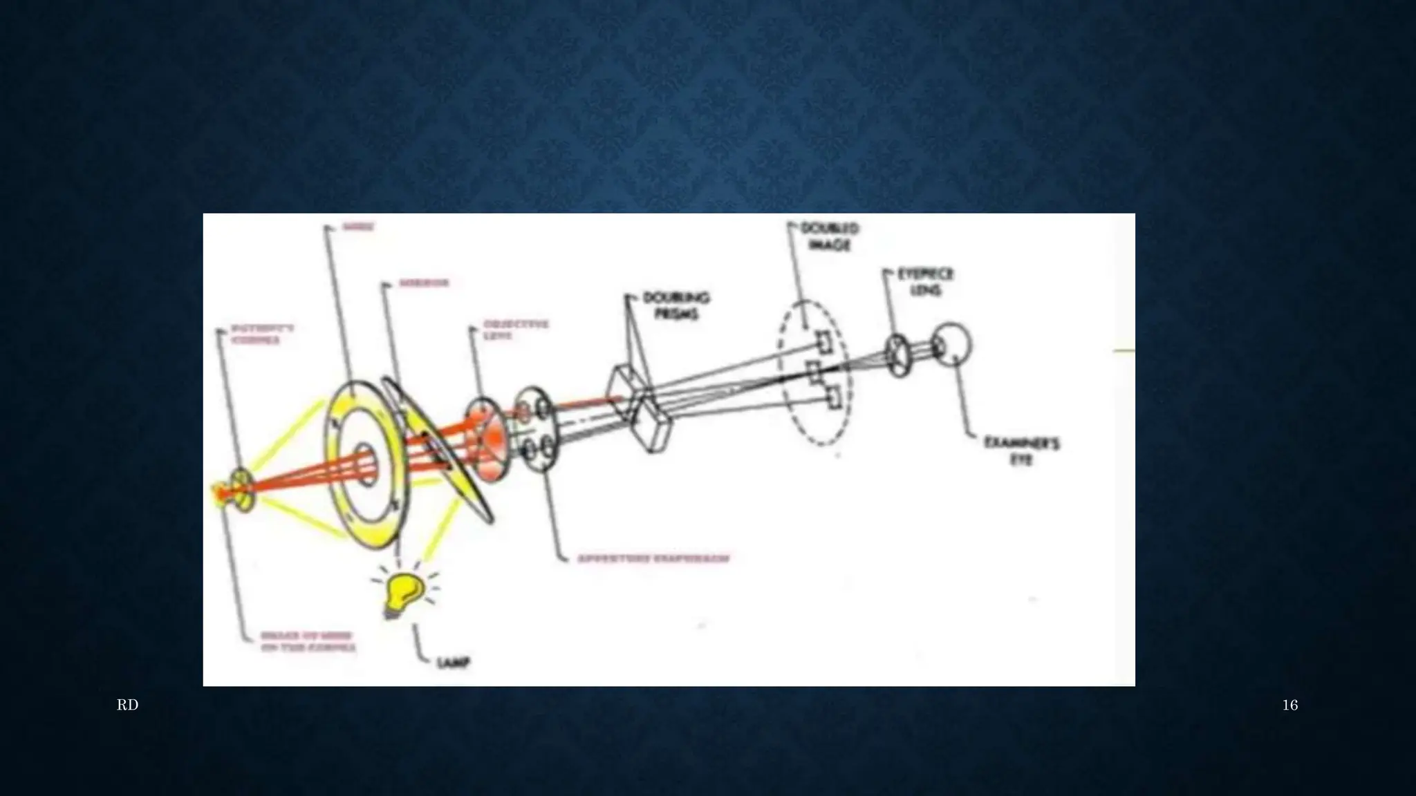 Extended keratometer and keratometry procedure | PPTX