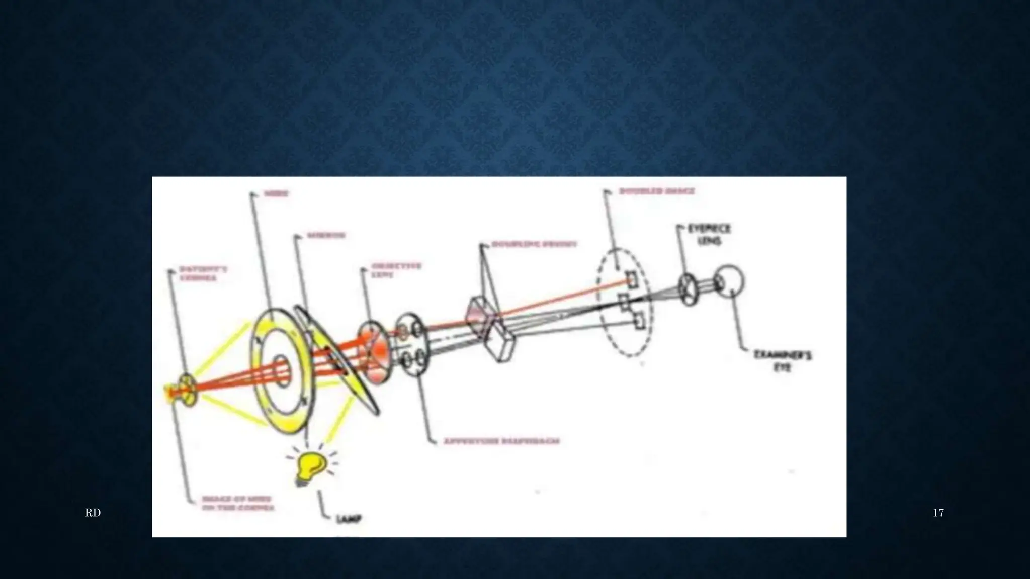 Extended keratometer and keratometry procedure | PPTX