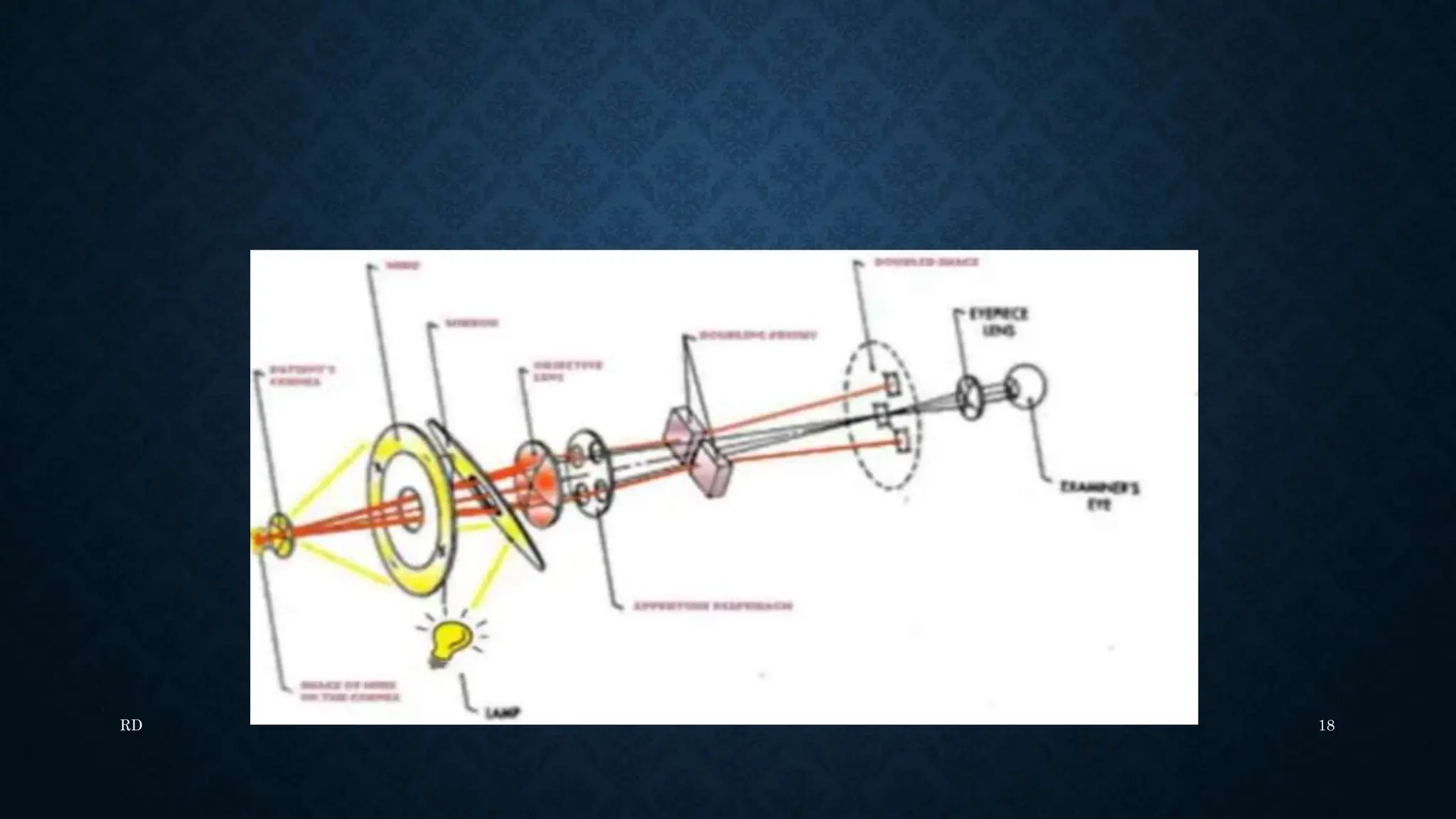 Extended keratometer and keratometry procedure | PPTX
