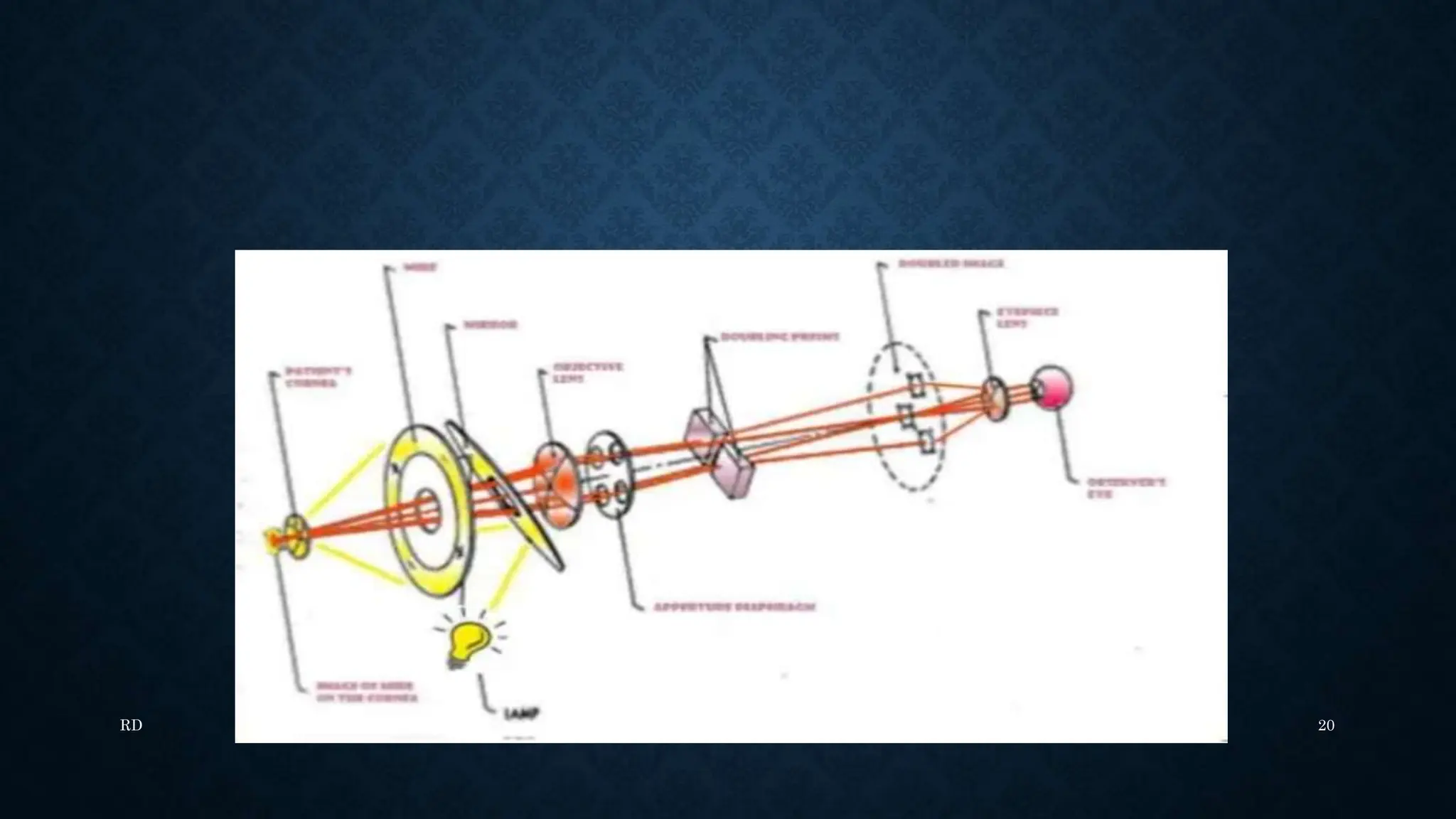 Extended keratometer and keratometry procedure | PPTX