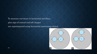 Extended keratometer and keratometry procedure | PPTX