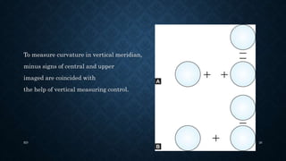Extended keratometer and keratometry procedure | PPTX