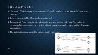 Extended keratometer and keratometry procedure | PPTX