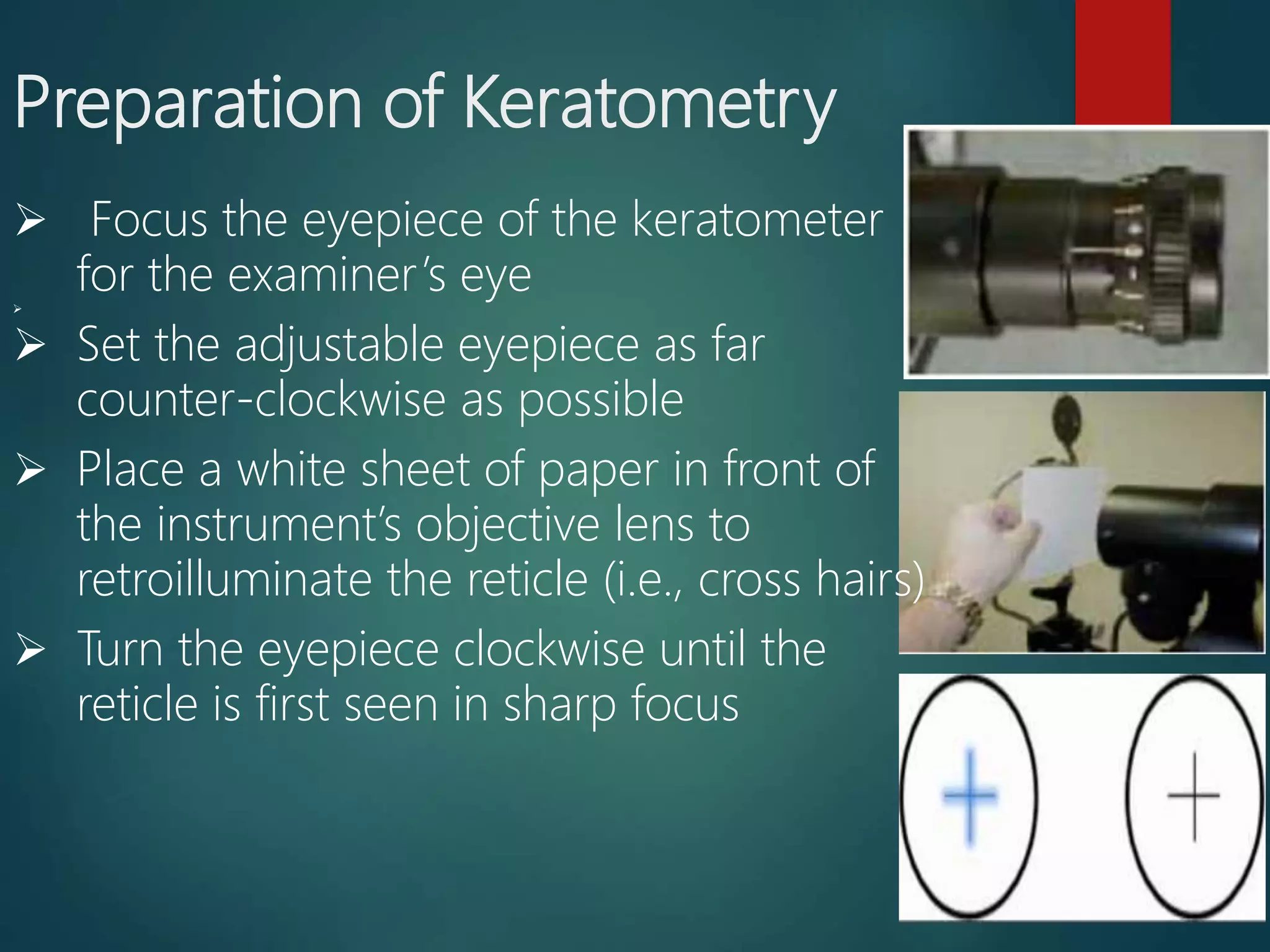Keratometry and Dynamic Retinoscopy | PPTX