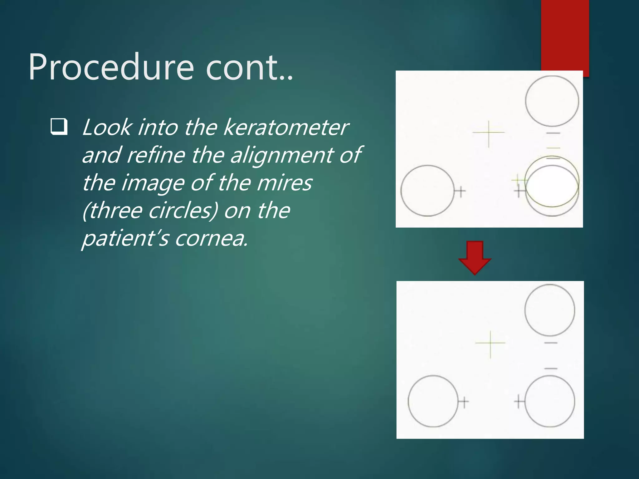 Keratometry and Dynamic Retinoscopy | PPTX