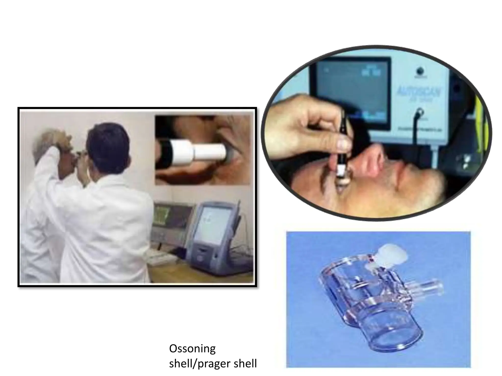 KERATOMETRY AND IOL POWER CALCULATION-1.pptx