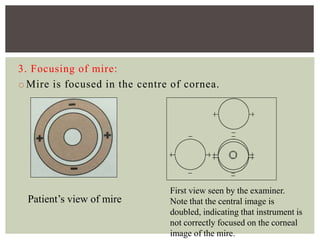 Keratometry & autorefraction | PPTX