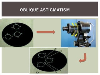 Keratometry & autorefraction | PPTX