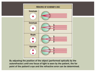 Keratometry & autorefraction | PPTX