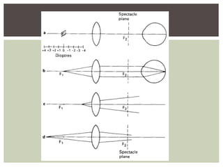 Keratometry & autorefraction | PPTX