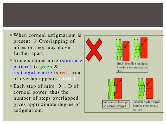 Keratometry & autorefraction