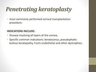 Keratoplasty | PPTX