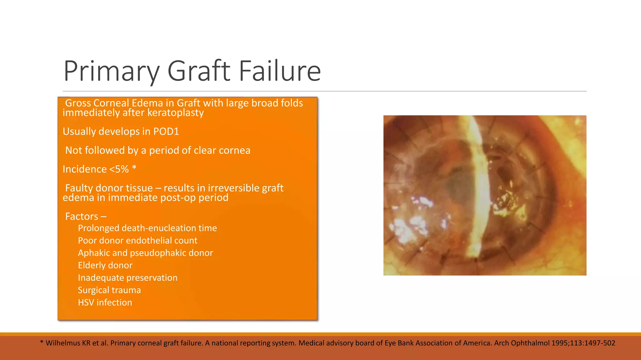 Keratoplasty associated complications | PPTX