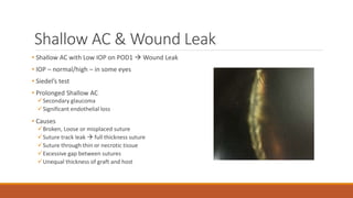 Keratoplasty associated complications | PPTX