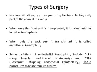 Keratoplasty patient education | PPTX