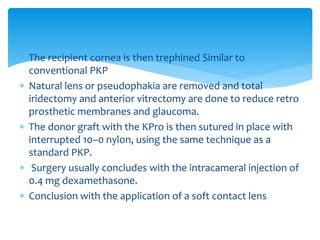 Keratoprosthesis | PPTX