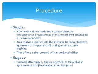 Keratoprosthesis | PPTX