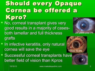 Keratoprosthesis – when, which, how 2013 | PPT
